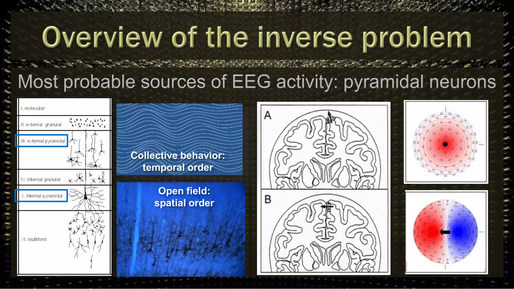Tognoli: Using Grey matter constraints to estimate EEG sources | PPT
