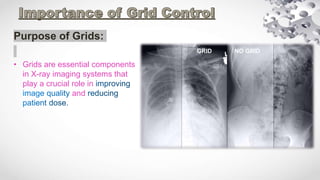 X-ray imaging, also known as radiography. | PPTX