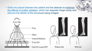X-ray imaging, also known as radiography. | PPTX