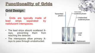 X-ray imaging, also known as radiography. | PPTX