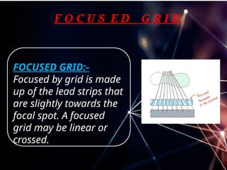 Grids and Types Of Grids and Airgap gap technique | PPTX