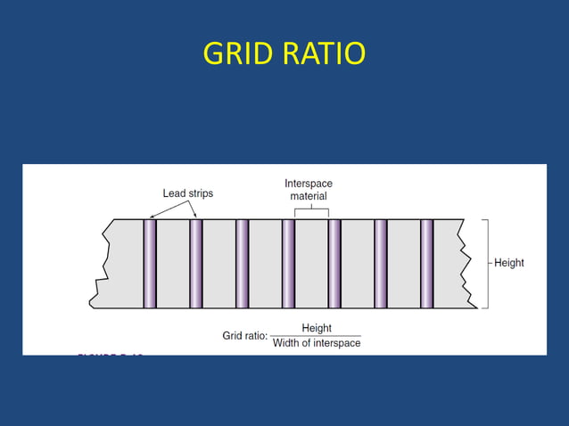 Grids | PDF