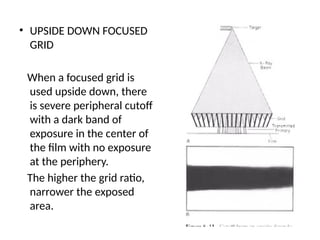 Xray Grids their use and types physics behind its use and how it ...