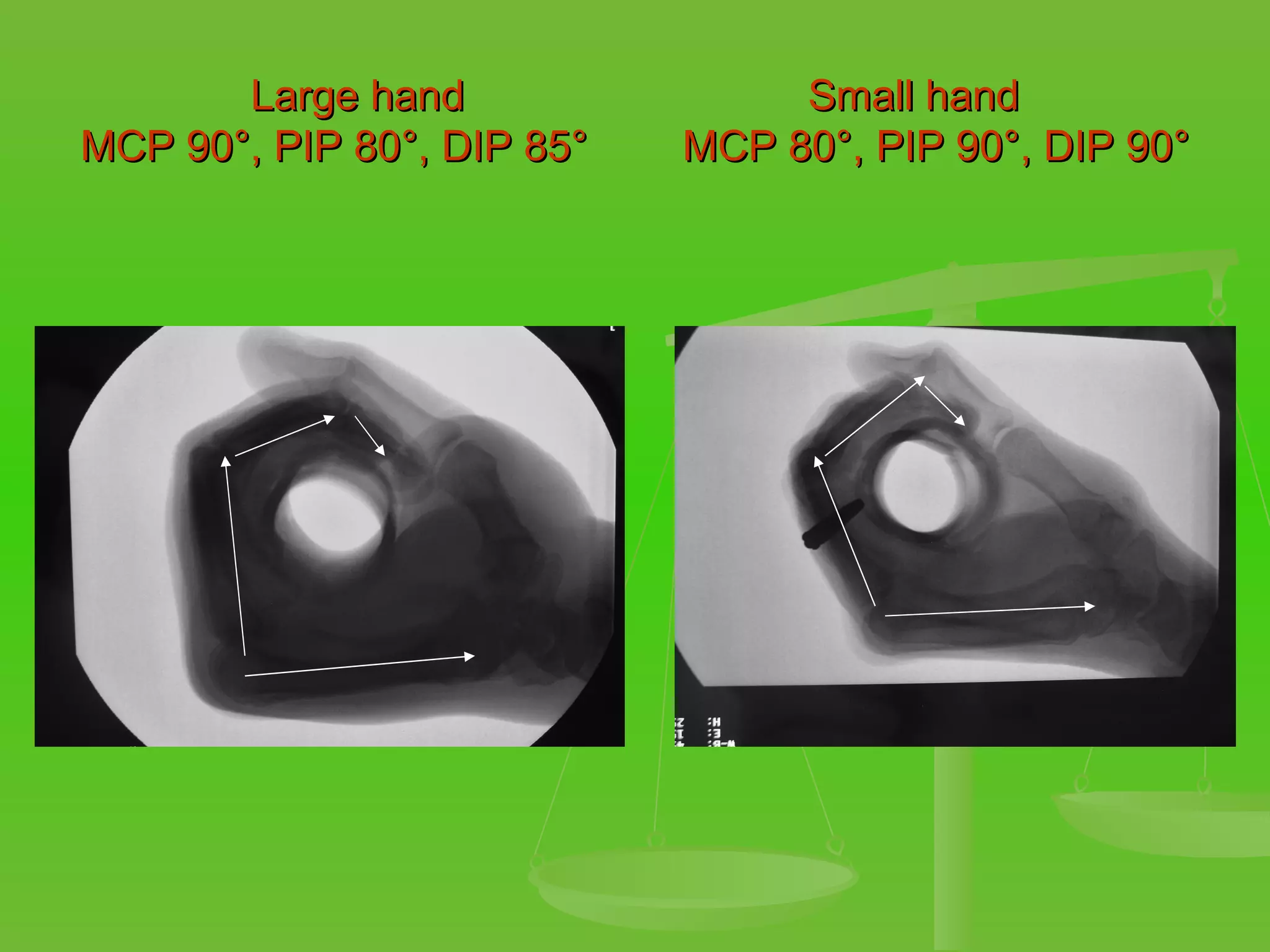 Hand Therapy - Grip Strength Measurement | PPT