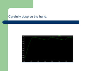 Grippers and lifting mechanisms | PDF