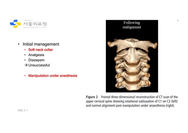 Grisel's syndrome | PDF | Ear, Nose and Throat Conditions | Diseases ...