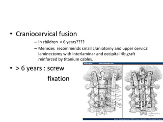 Grisel syndrome | PPTX