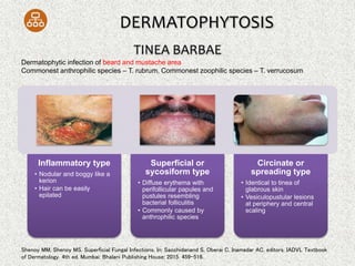 Oral Griseofulvin in Dermatology | PPTX