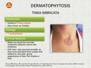 Oral Griseofulvin in Dermatology | PPTX