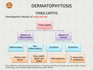 Oral Griseofulvin in Dermatology | PPT