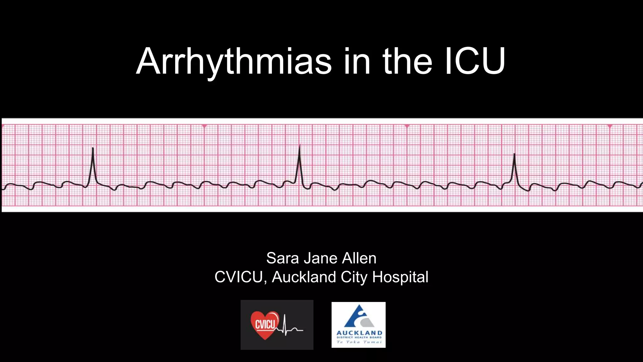 Arrhythmias in the ICU: An Intensivist’s approach by Dr Sara Allen | PPTX