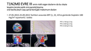 vaka sunumu nazofarenks kanseri dr.emin mammadov | PPTX