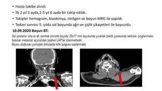 vaka sunumu nazofarenks kanseri dr.emin mammadov | PPTX