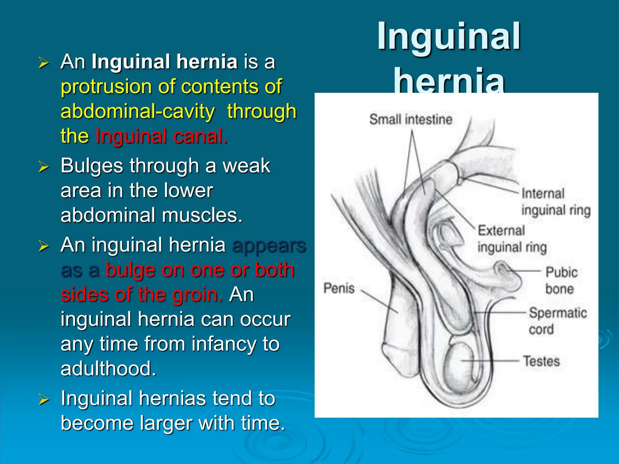 Groin anatomy inguinal hernia clinical anatomy | PPT