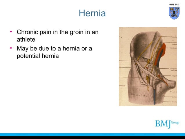Anatomy of Groin | PPT | Sexual Conditions | Sexual Health