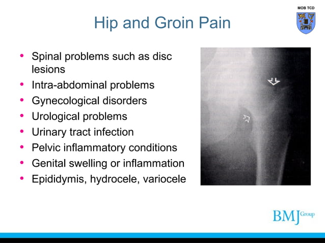 Anatomy of Groin | PPT | Sexual Conditions | Sexual Health