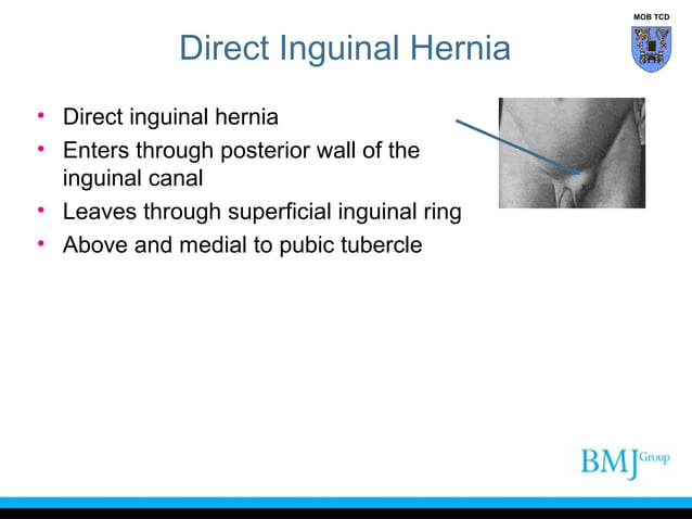 Anatomy of Groin | PPT | Sexual Conditions | Sexual Health