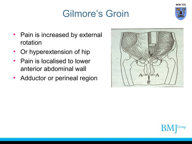 Anatomy of Groin | PPT