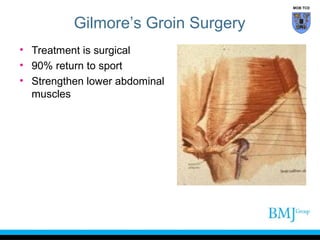 Anatomy of Groin | PPT