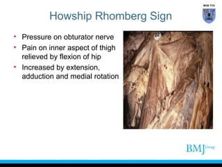 Anatomy of Groin | PPT