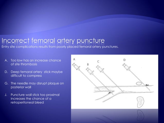 Groin complications and Management 2011 | PPT