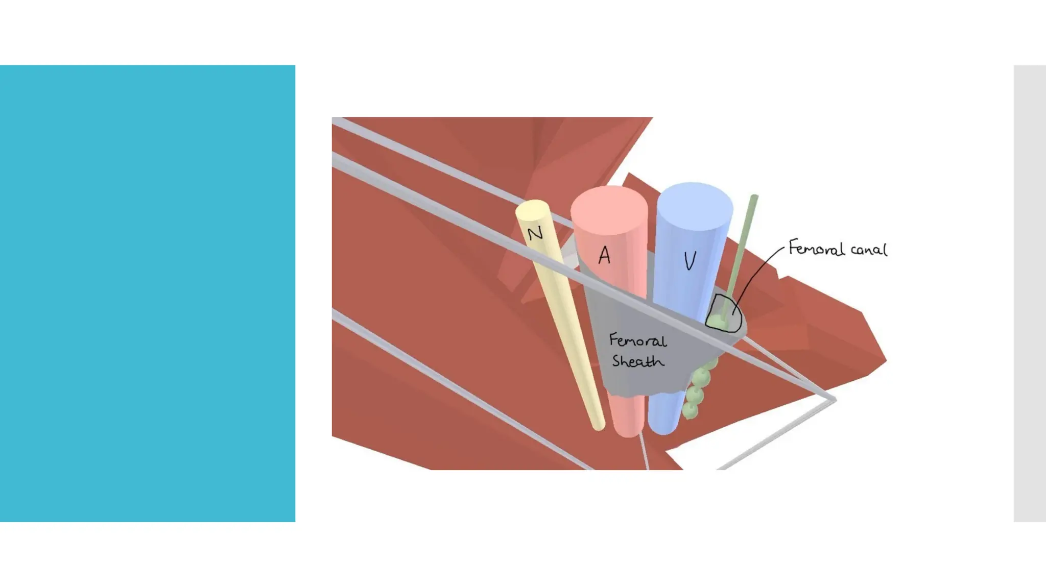 Groin Hernias types history and operations | PPT
