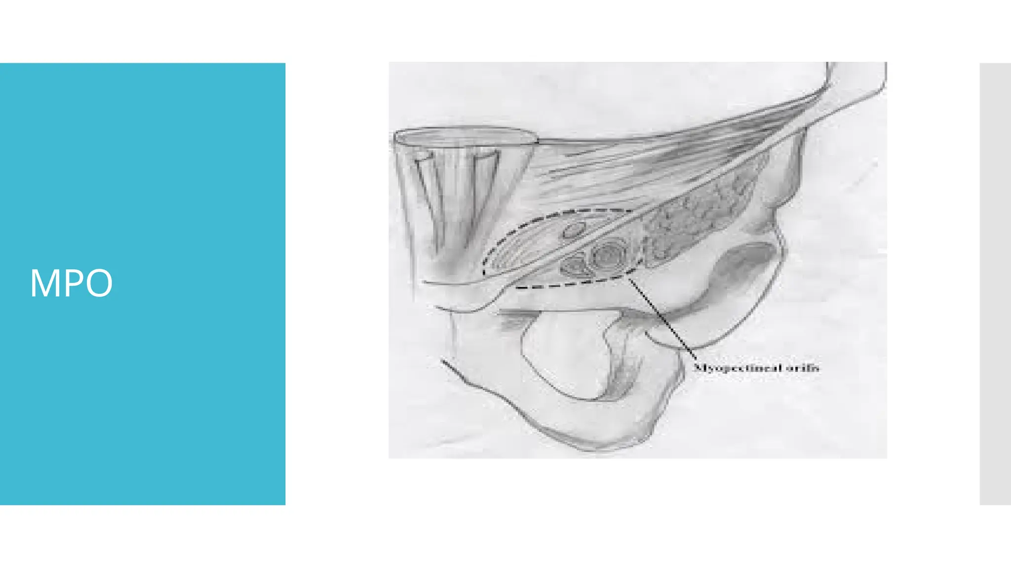 Groin Hernias types history and operations | PPT