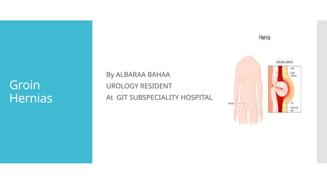 Groin Hernias types history and operations | PPT