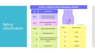 Groin Hernias types history and operations | PPTX