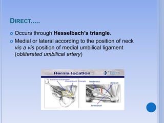 Groin hernias | PPTX