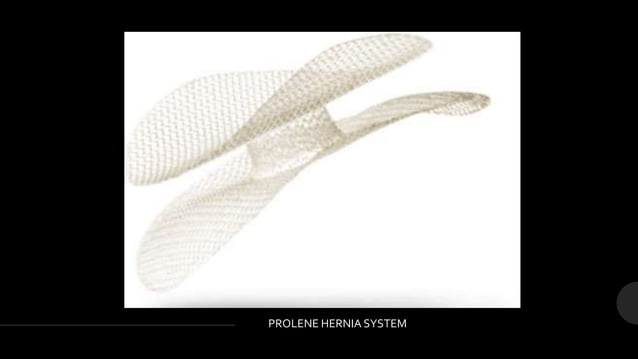 Groin hernias | PPT