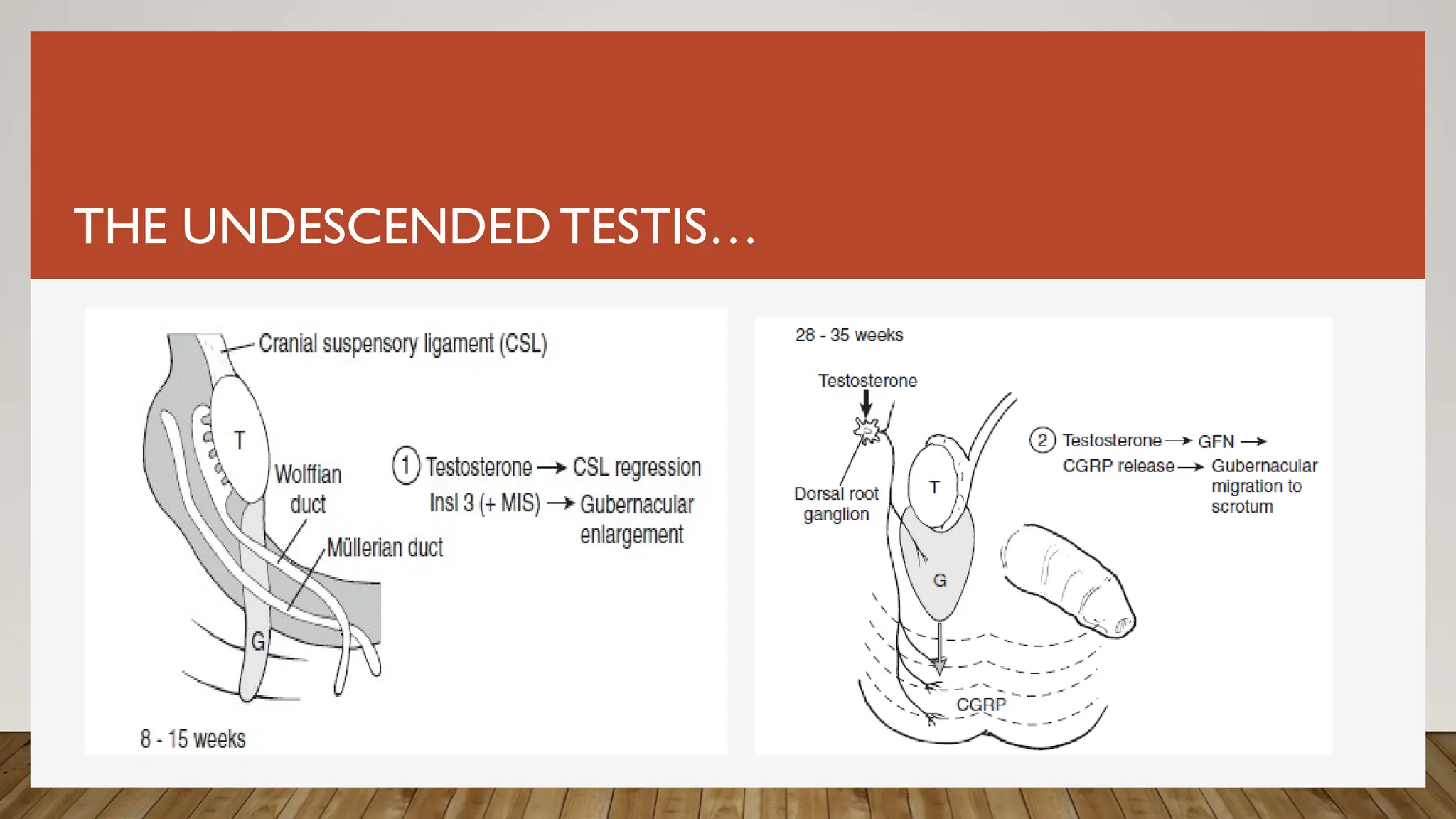 Groin Lump In Children which needs Surgery | PPT