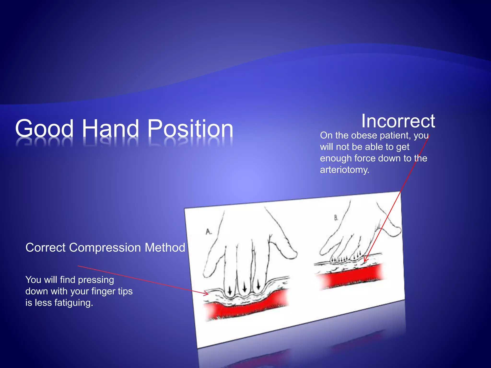 Groin management 2013 | PPTX