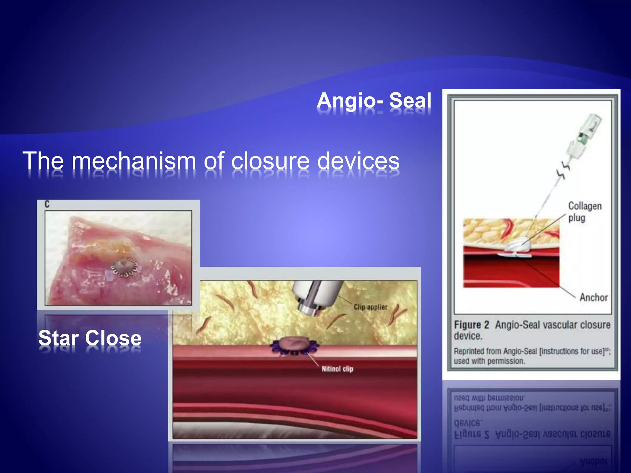 Groin management 2013 | PPTX