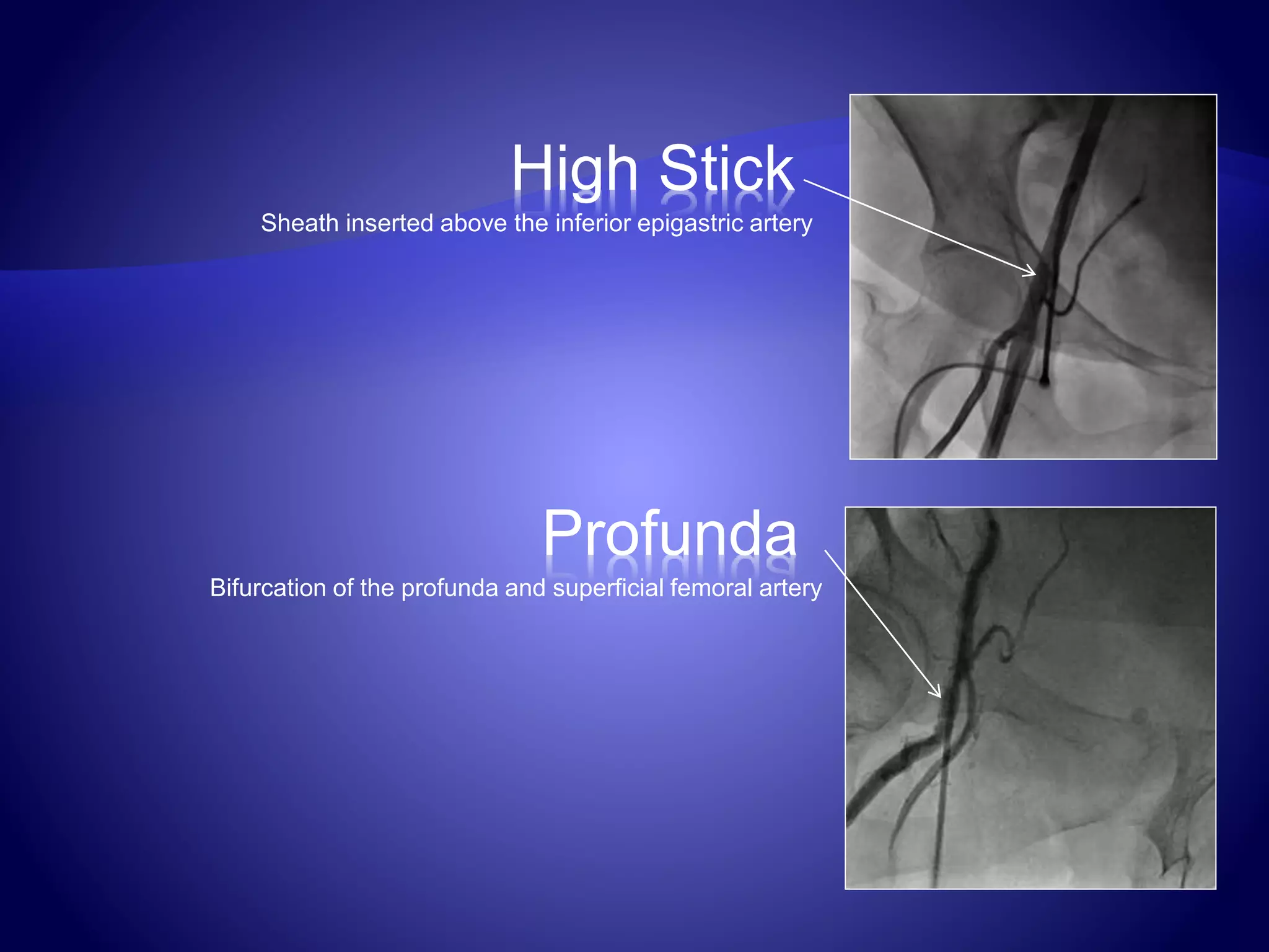 Groin management 2013 | PPTX