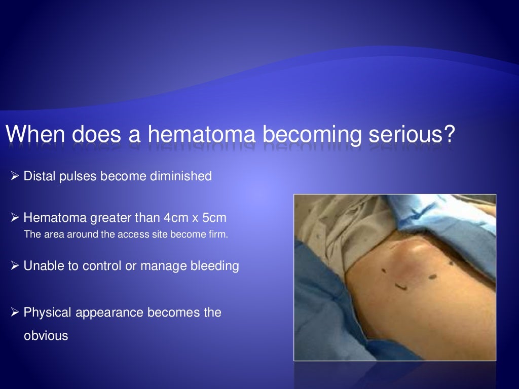 Groin management 2013