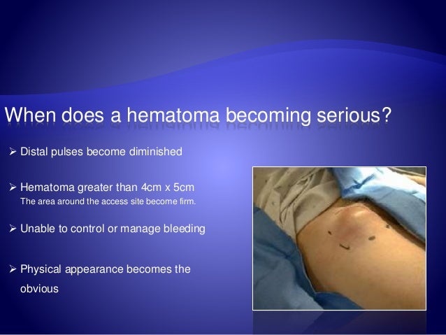 Groin management 2013