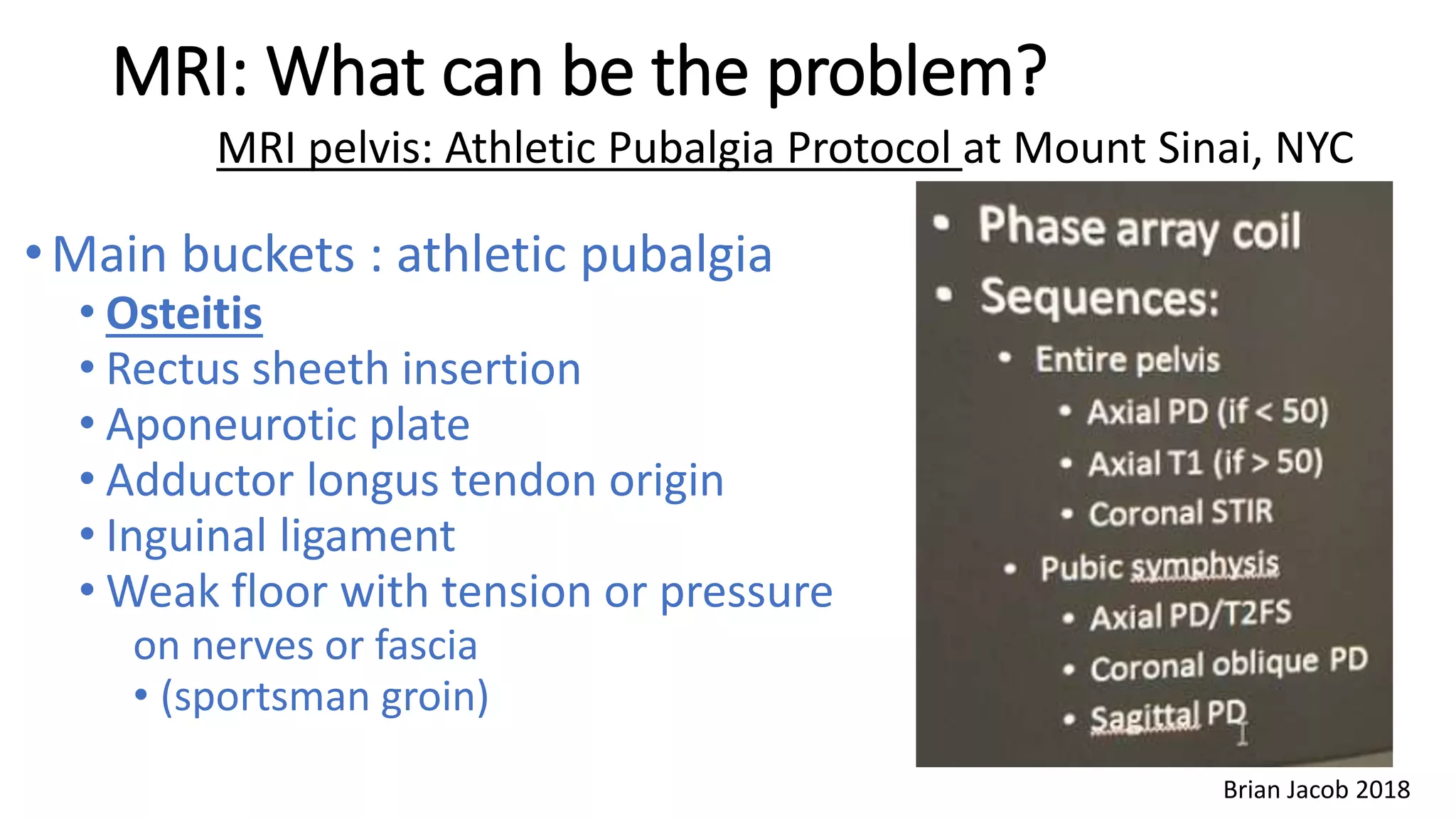 Groin pain and hernia exam final by dr. brian jacob | PPTX | Death ...