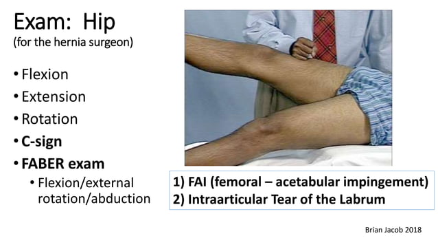 Groin pain and hernia exam final by dr. brian jacob | PPT