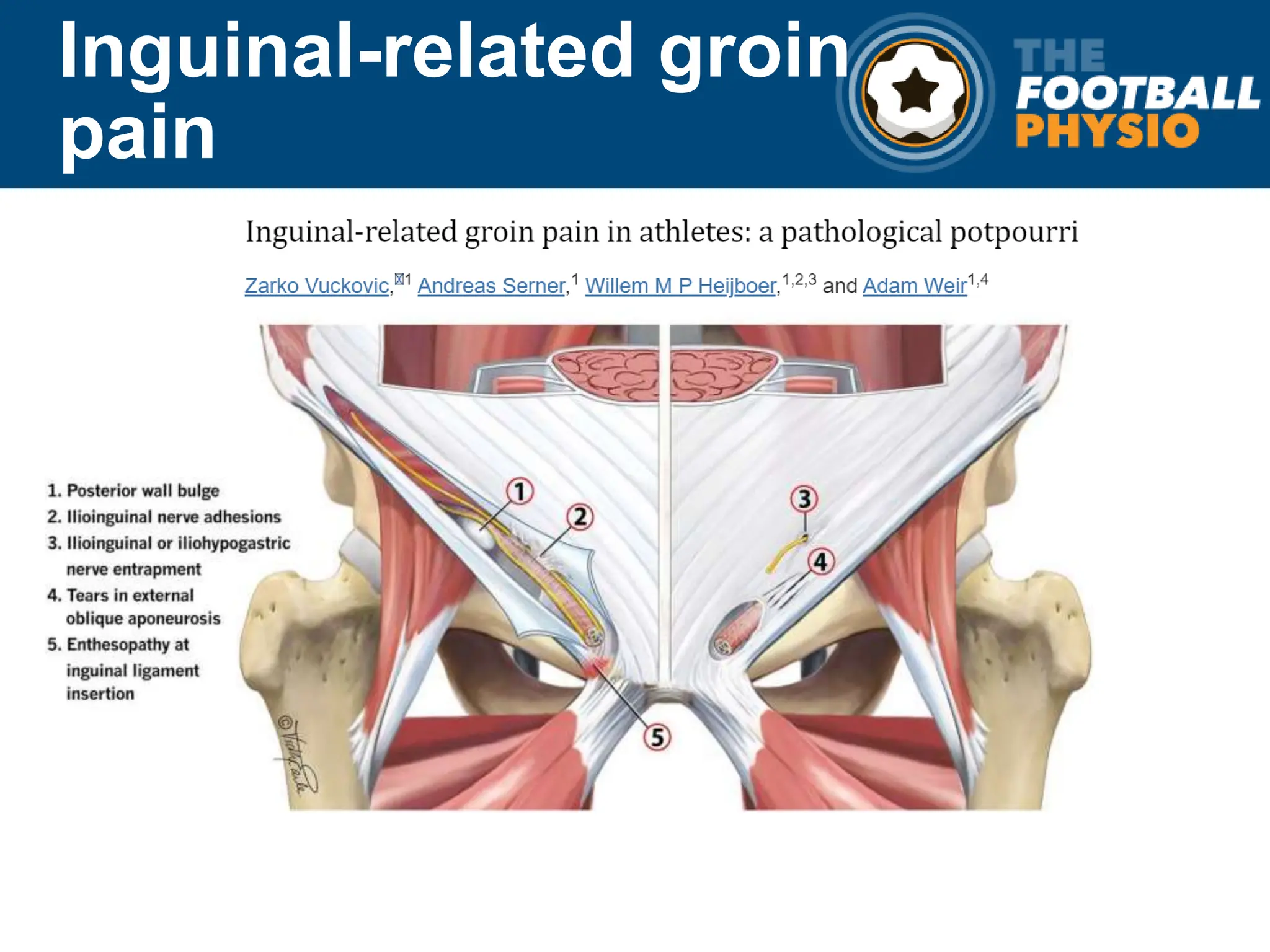 Groin Pres - Final.pptx