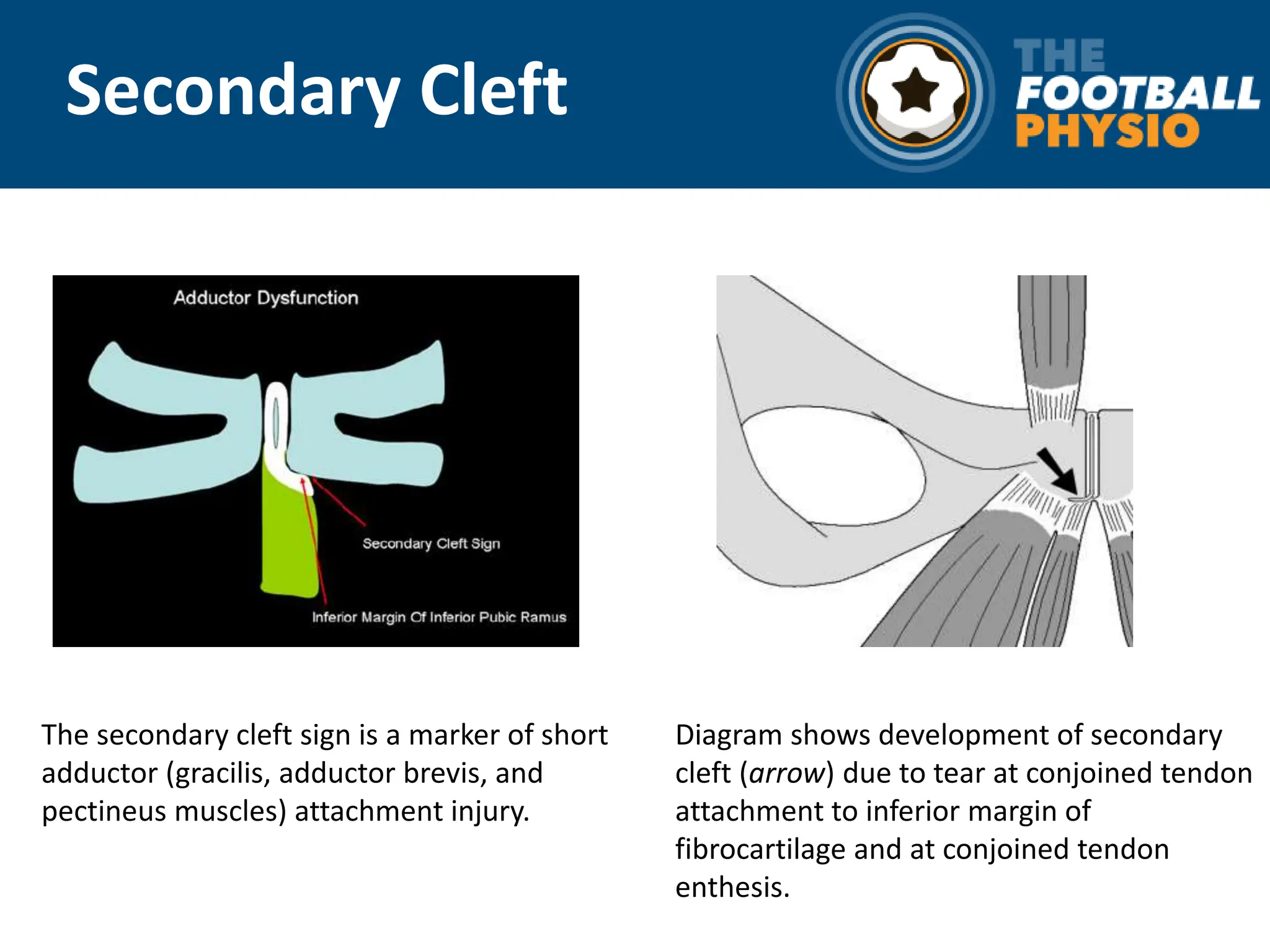 Groin Pres - Final.pptx