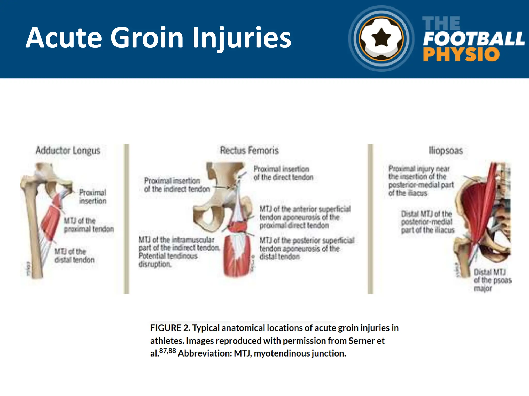 Groin Pres - Final.pptx