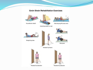 Groin strain | PPTX