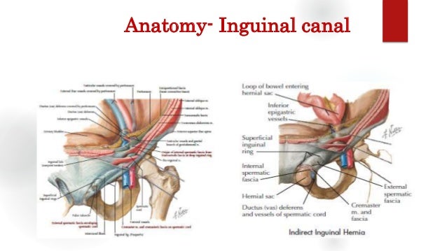 Groin Swellings Introduction