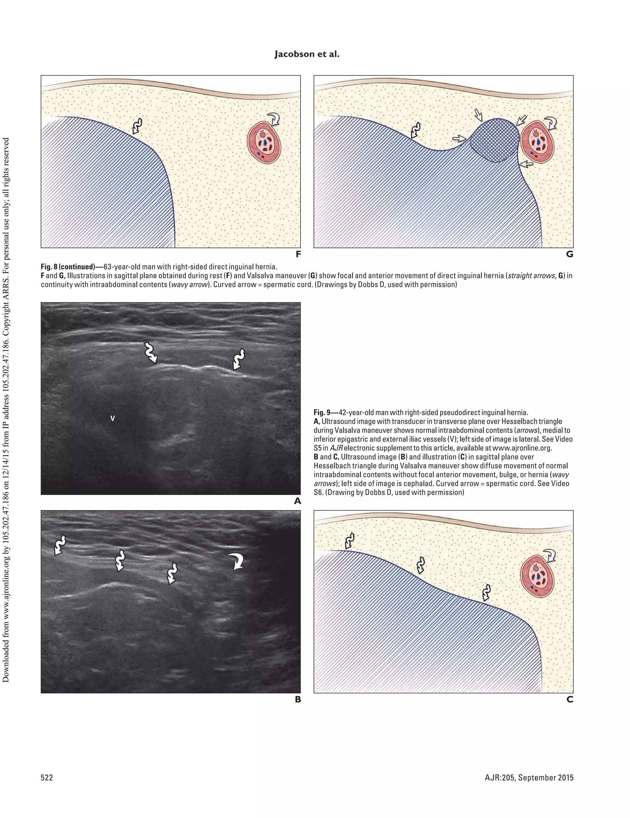 Groin us | PDF
