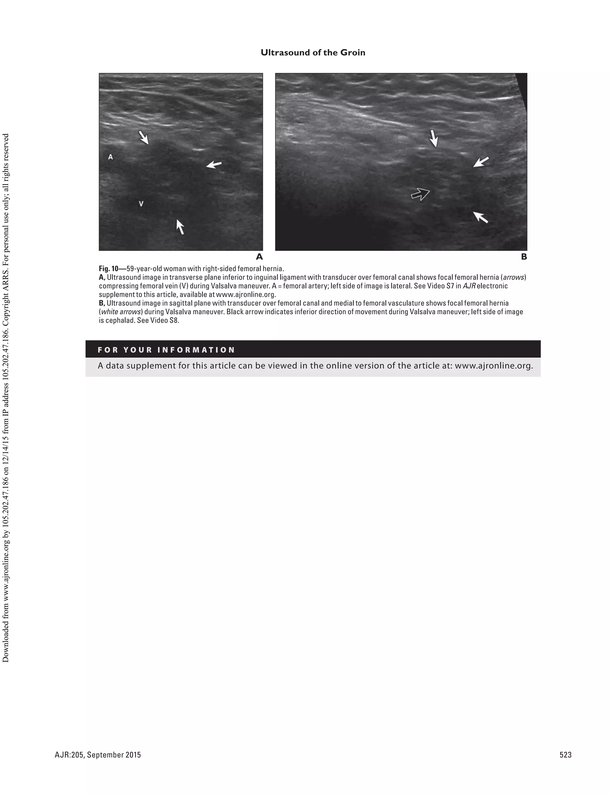Groin us | PDF