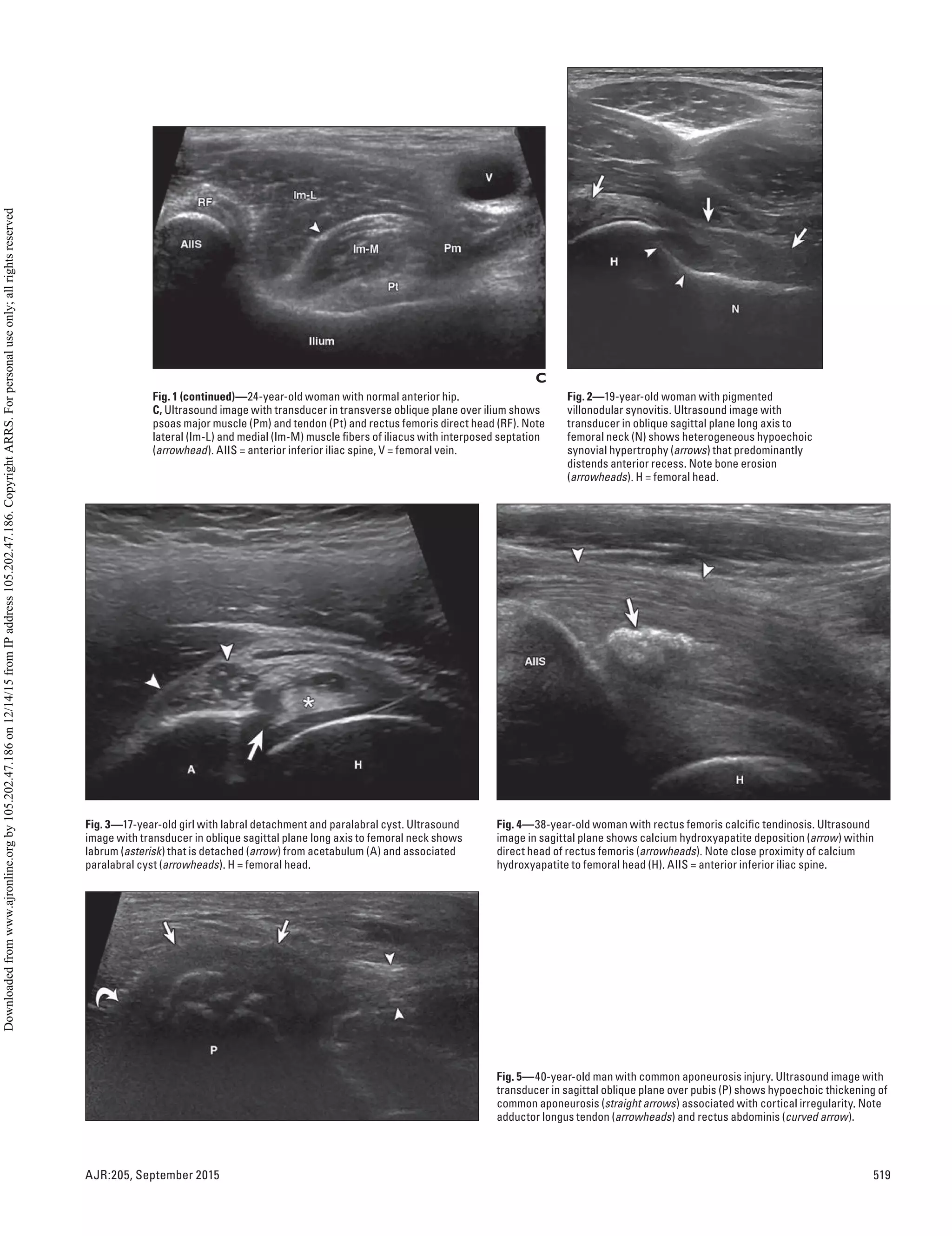 Groin us | PDF