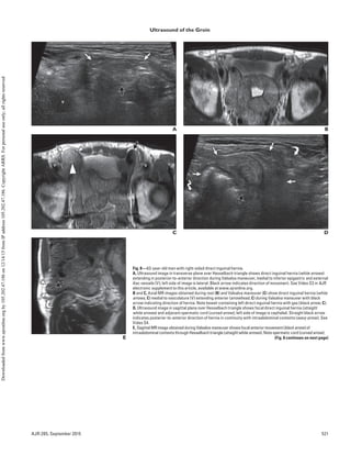 Groin us | PDF