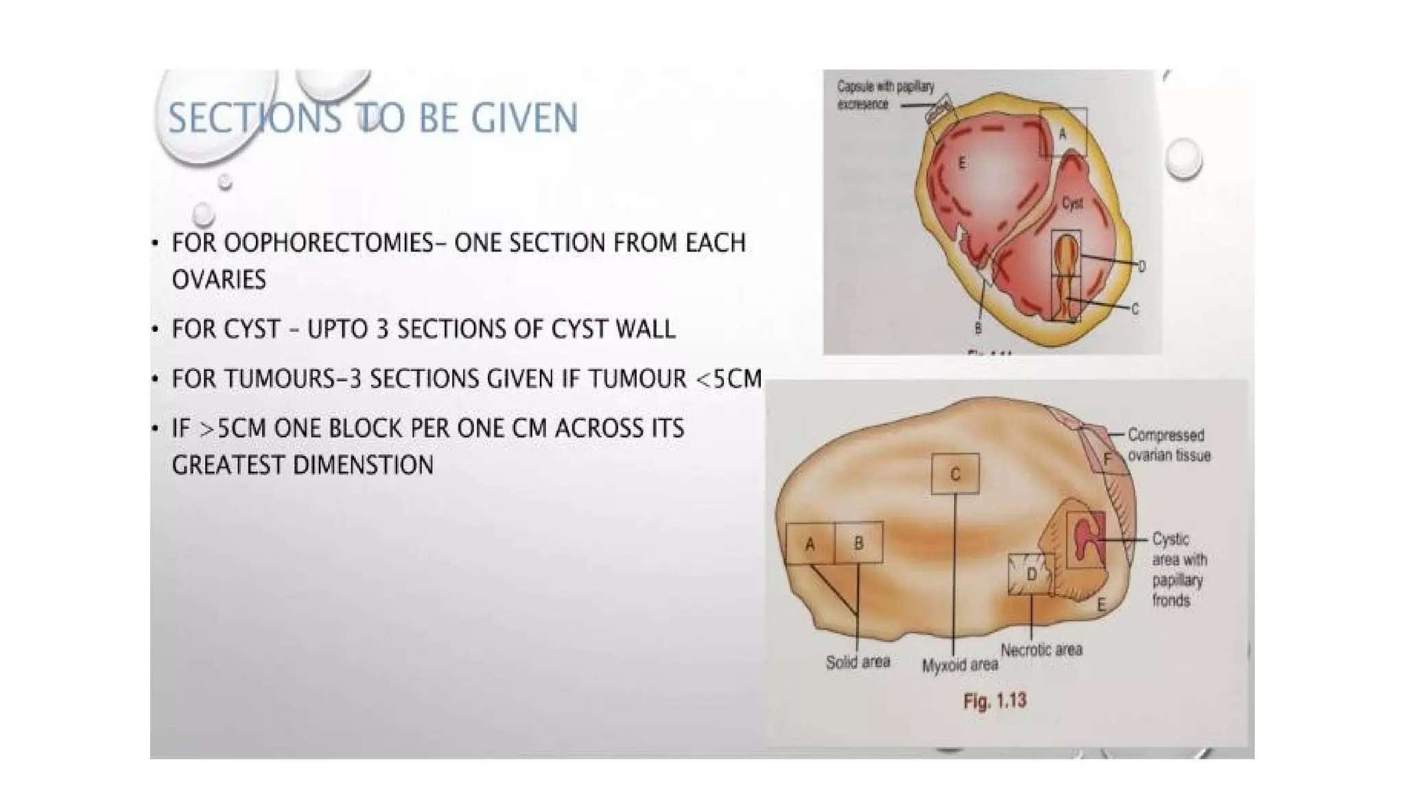 Female genital tract grossing techniques and major lesions.pptx