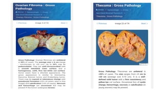 Female genital tract grossing techniques and major lesions.pptx